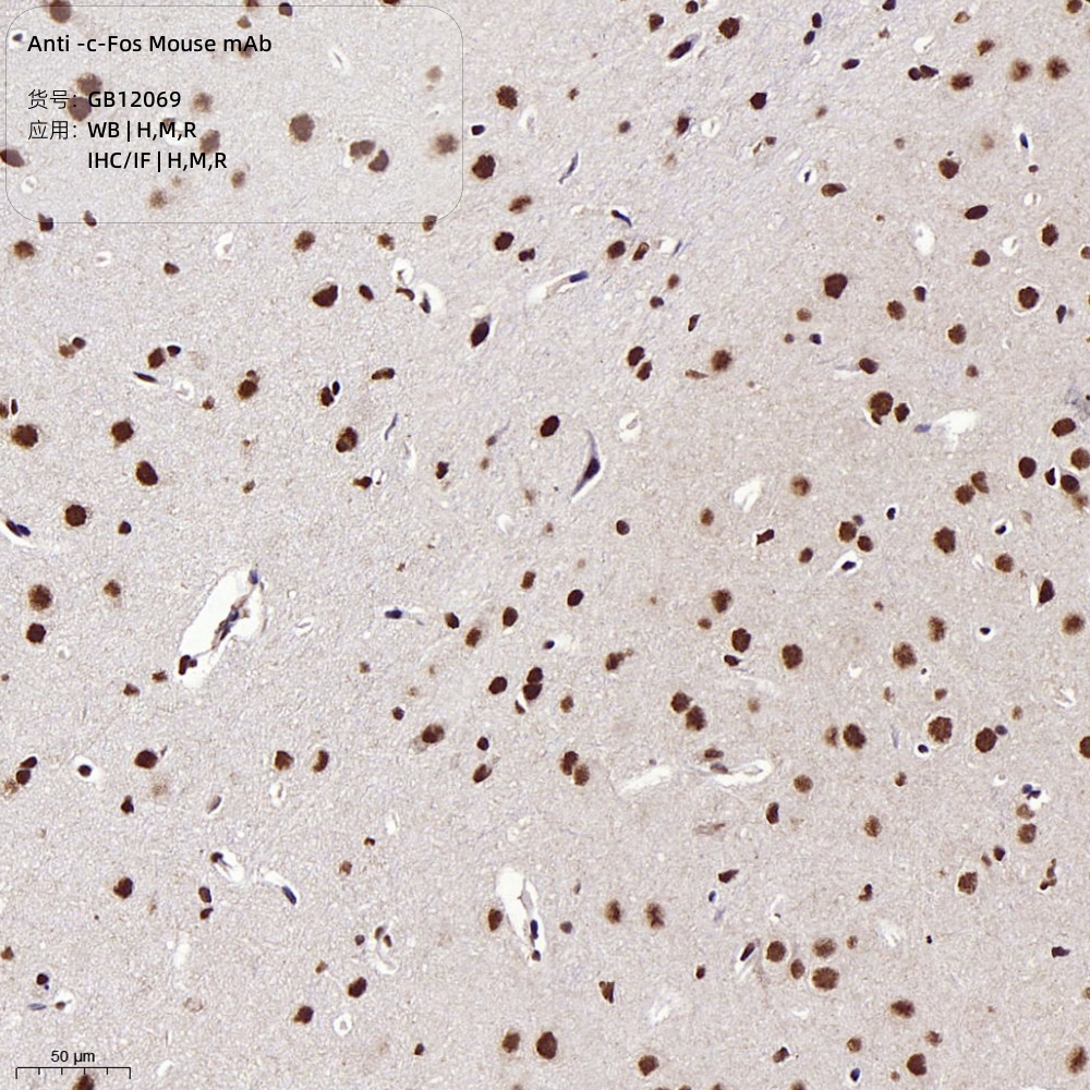 赛维尔生物服务|产品_Servicebio_武汉赛维尔生物科技有限公司