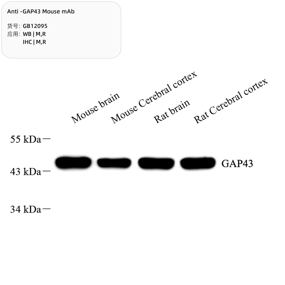 赛维尔生物服务|产品_Servicebio_武汉赛维尔生物科技有限公司
