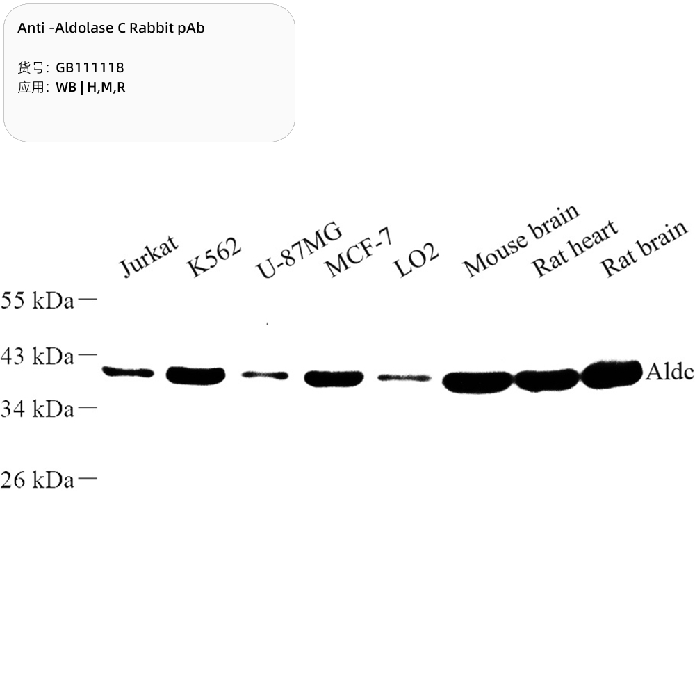 赛维尔生物服务|产品_Servicebio_武汉赛维尔生物科技有限公司