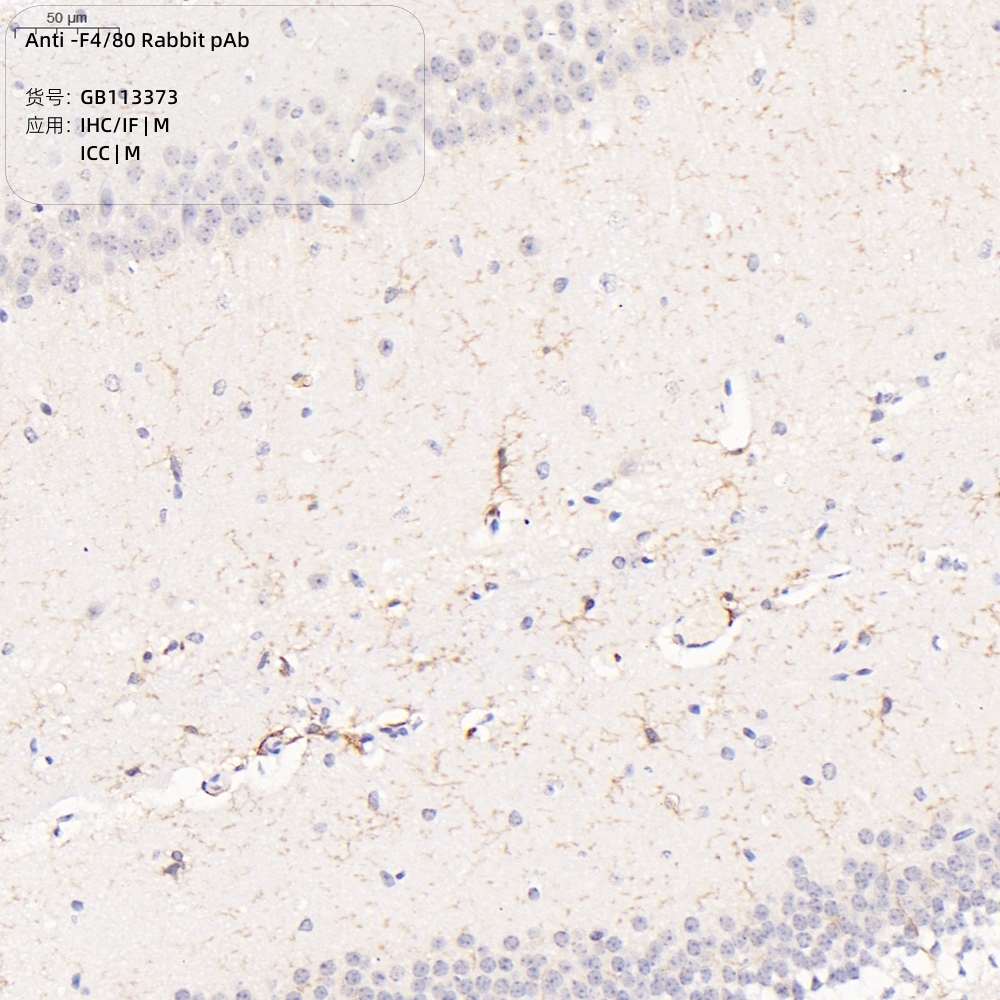 Servicebio Biological | Products _Servicebio_ Wuhan Servicebio ...