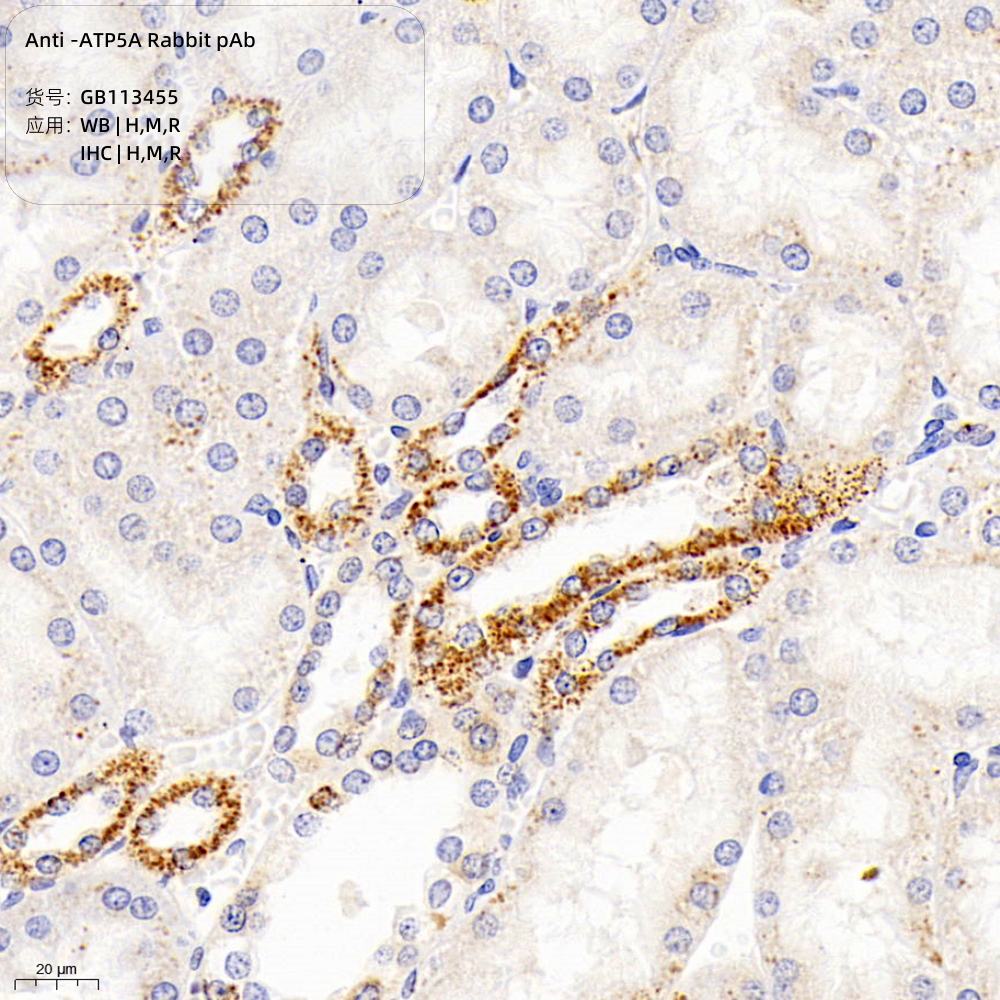 赛维尔生物服务|产品_Servicebio_武汉赛维尔生物科技有限公司