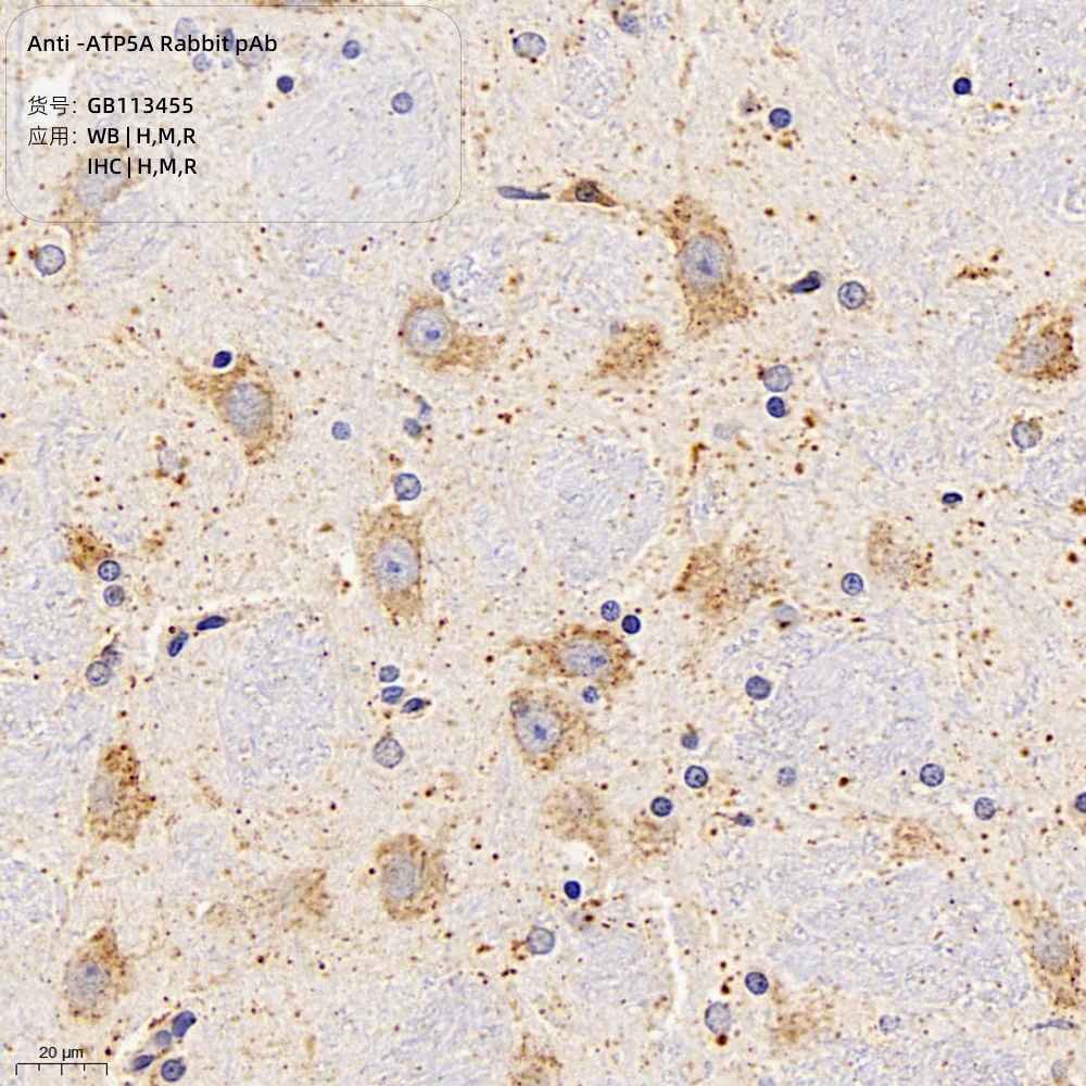 赛维尔生物服务|产品_Servicebio_武汉赛维尔生物科技有限公司