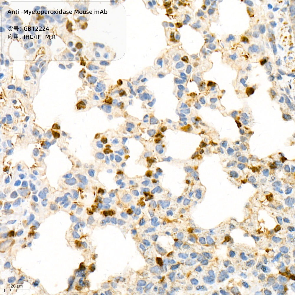赛维尔生物服务|产品_Servicebio_武汉赛维尔生物科技有限公司