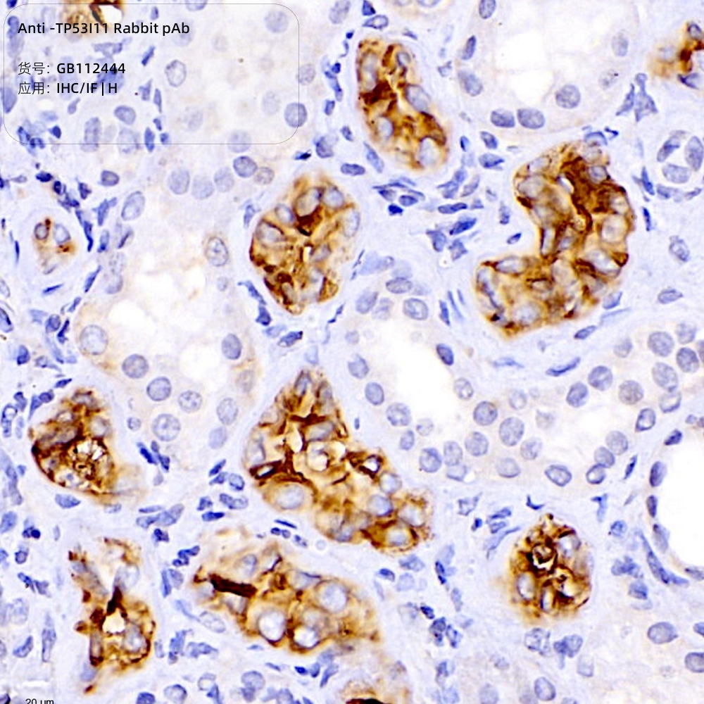 赛维尔生物服务|产品_Servicebio_武汉赛维尔生物科技有限公司
