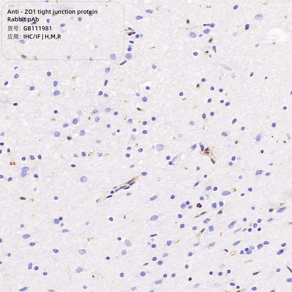 赛维尔生物服务|产品_Servicebio_武汉赛维尔生物科技有限公司