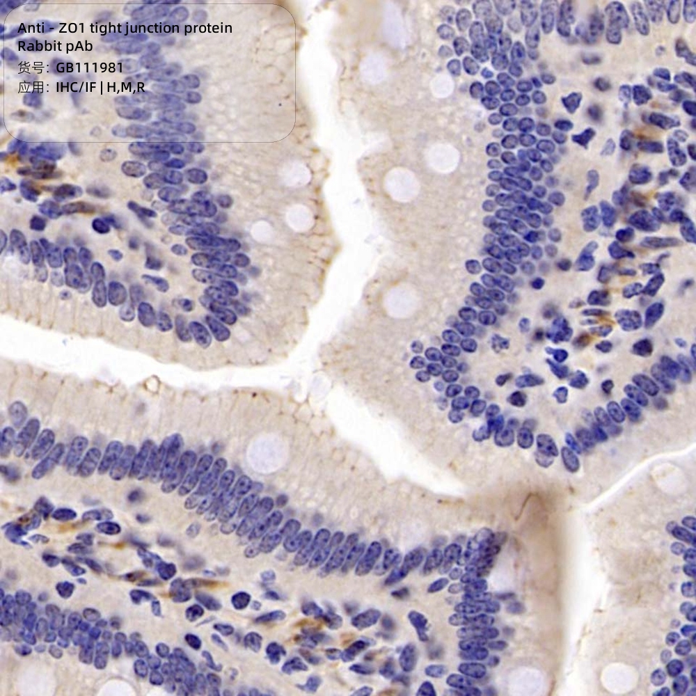 赛维尔生物服务|产品_Servicebio_武汉赛维尔生物科技有限公司
