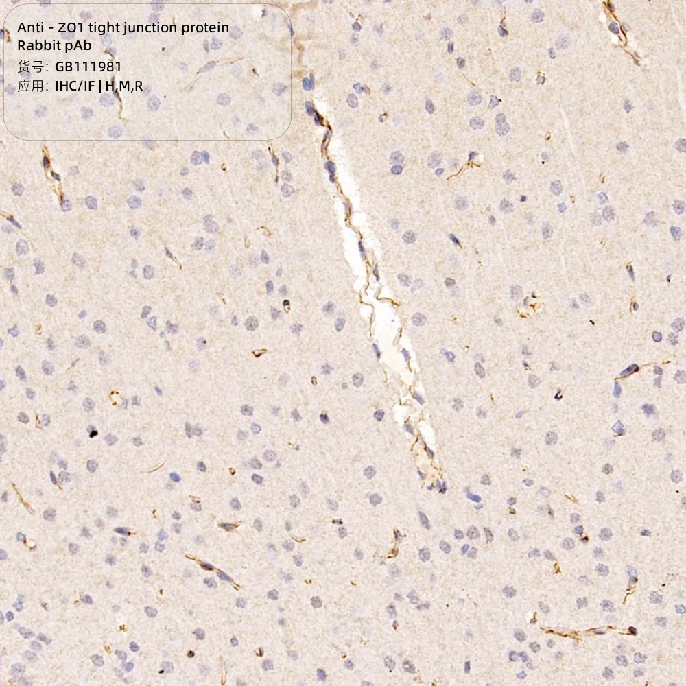 赛维尔生物服务|产品_Servicebio_武汉赛维尔生物科技有限公司