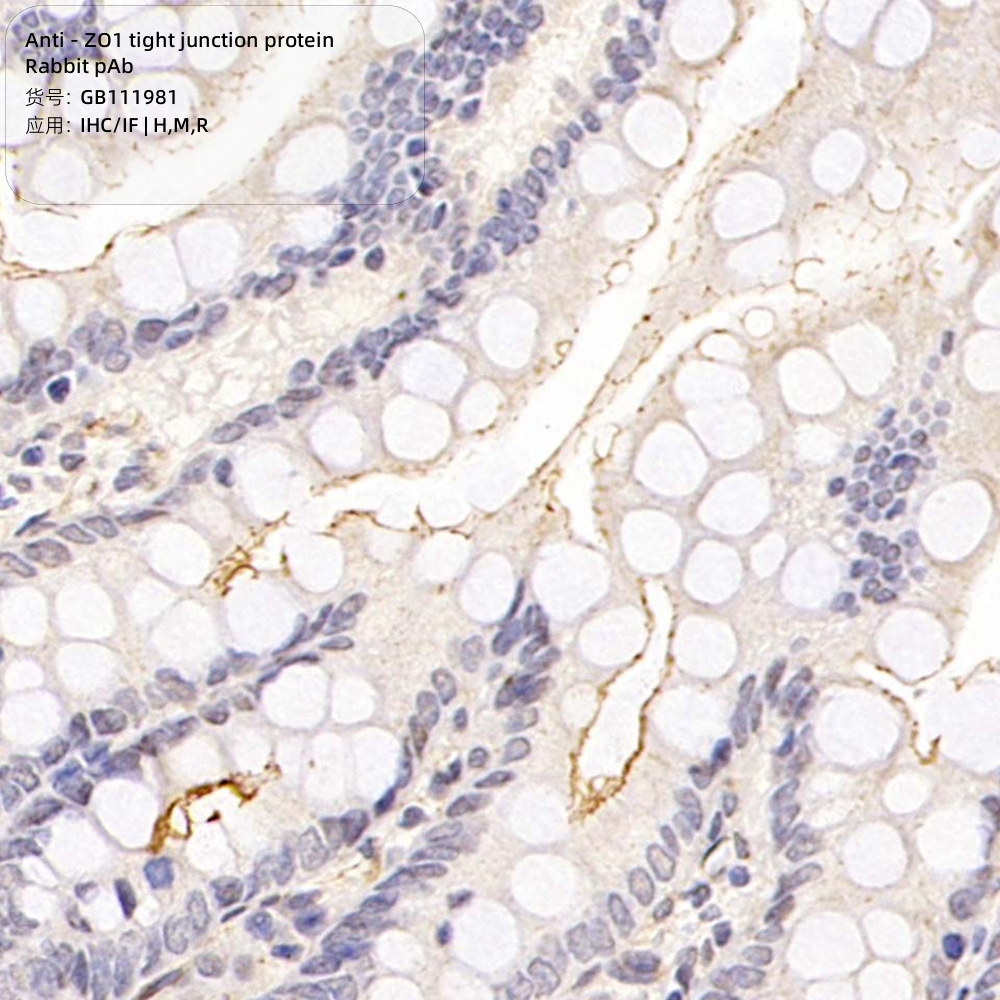 赛维尔生物服务|产品_Servicebio_武汉赛维尔生物科技有限公司