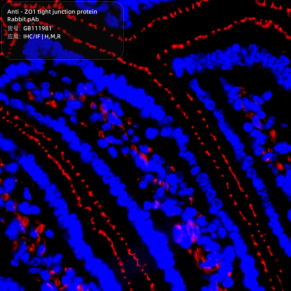 赛维尔生物服务|产品_Servicebio_武汉赛维尔生物科技有限公司