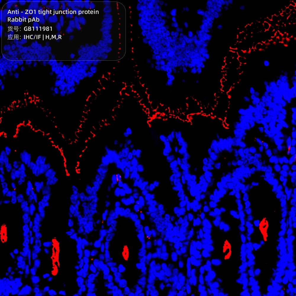 赛维尔生物服务|产品_Servicebio_武汉赛维尔生物科技有限公司