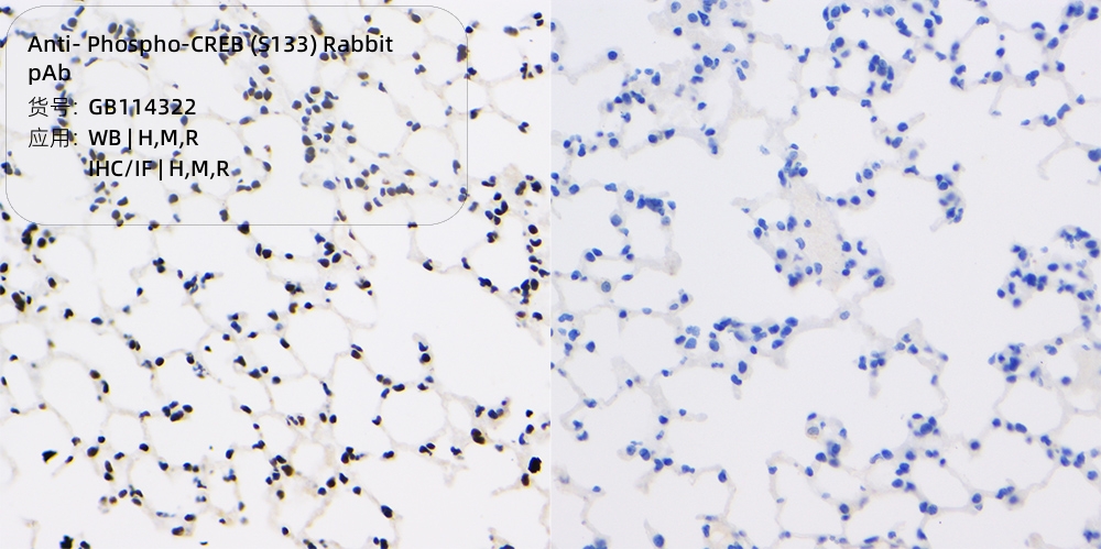 赛维尔生物服务|产品_Servicebio_武汉赛维尔生物科技有限公司