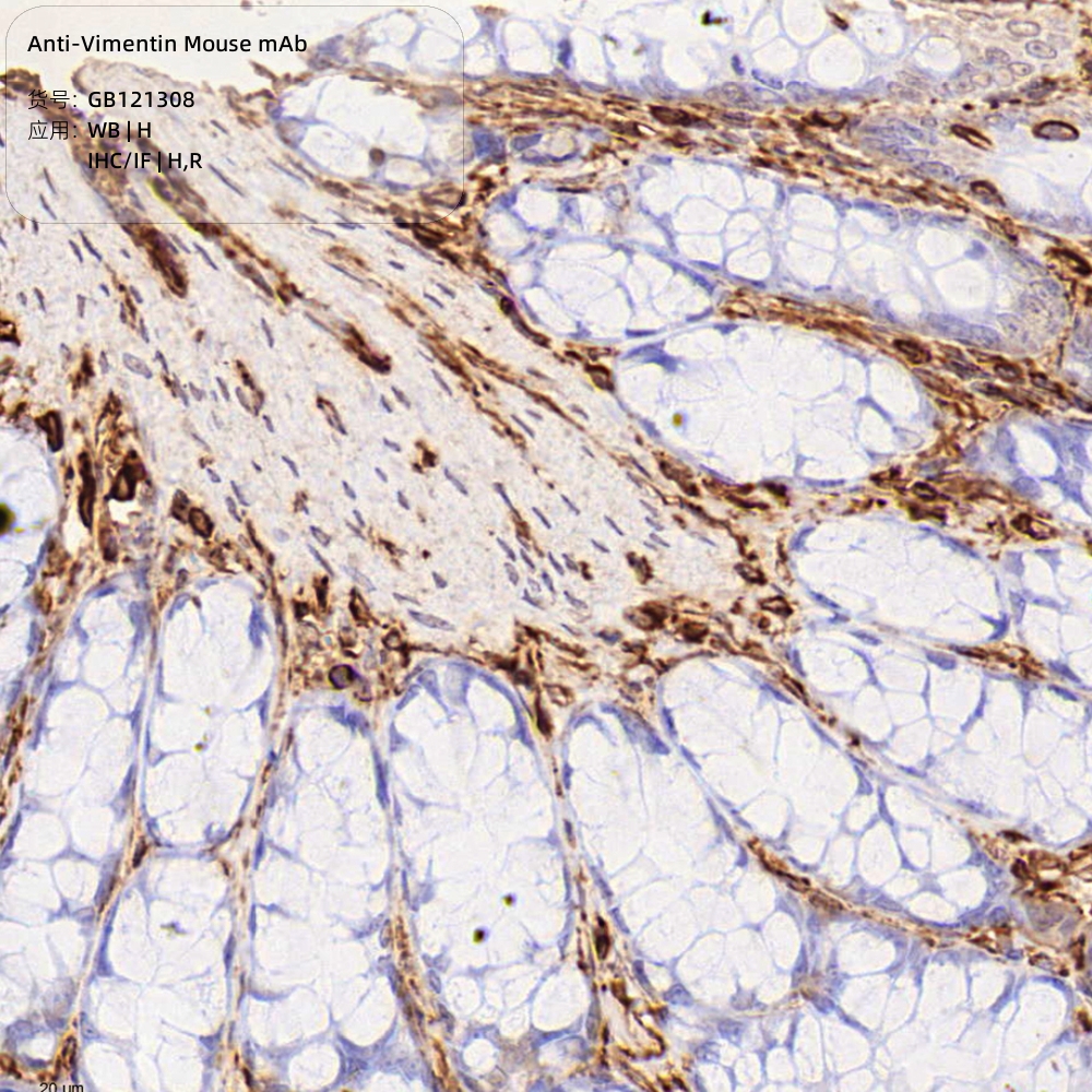 赛维尔生物服务|产品_Servicebio_武汉赛维尔生物科技有限公司