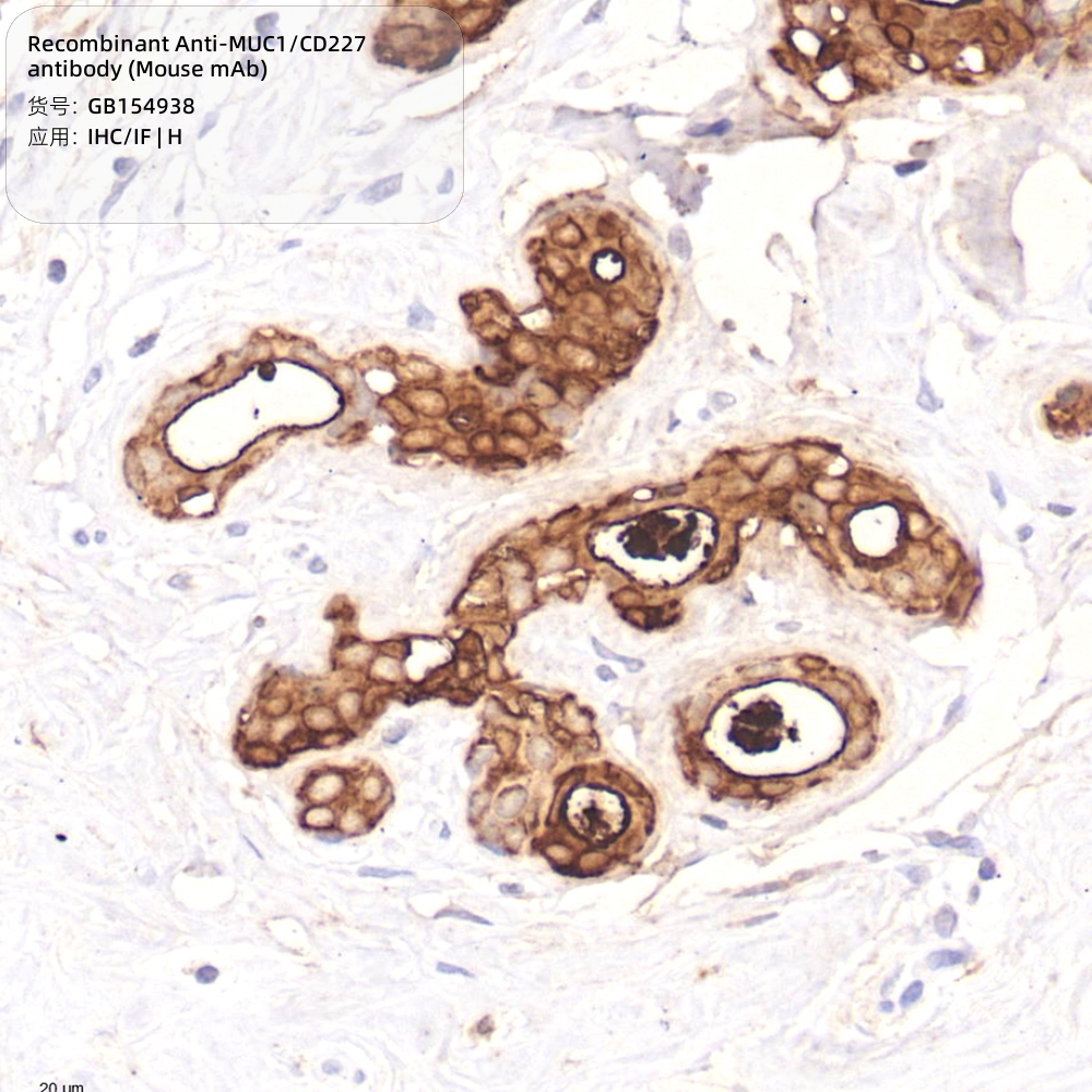 赛维尔生物服务|产品_Servicebio_武汉赛维尔生物科技有限公司