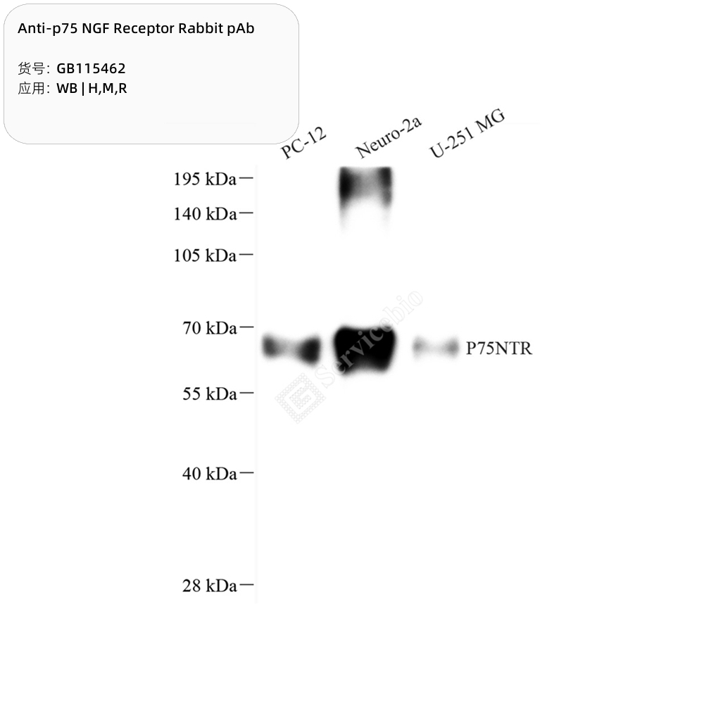 赛维尔生物服务|产品_Servicebio_武汉赛维尔生物科技有限公司