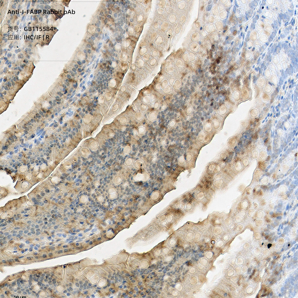 赛维尔生物服务|产品_Servicebio_武汉赛维尔生物科技有限公司