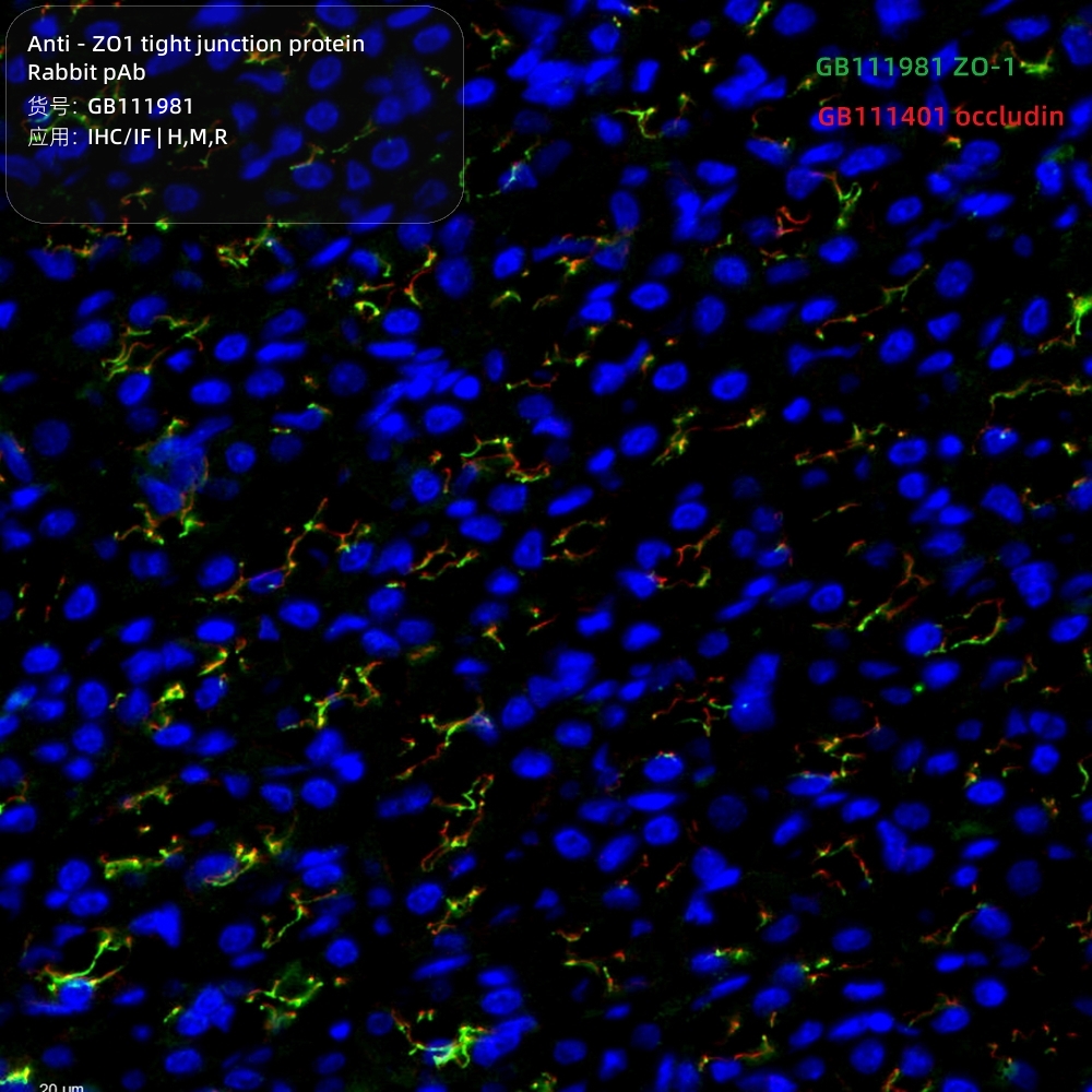 赛维尔生物服务|产品_Servicebio_武汉赛维尔生物科技有限公司
