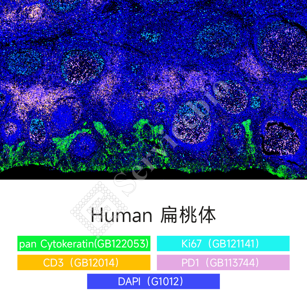 赛维尔生物服务|产品_Servicebio_武汉赛维尔生物科技有限公司