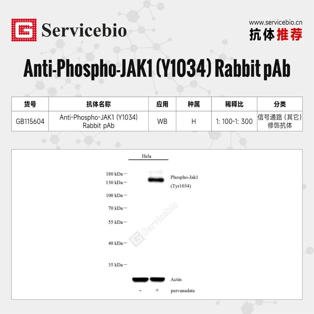 赛维尔生物服务|产品_Servicebio_武汉赛维尔生物科技有限公司