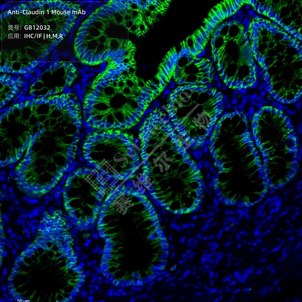 赛维尔生物服务|产品_Servicebio_武汉赛维尔生物科技有限公司