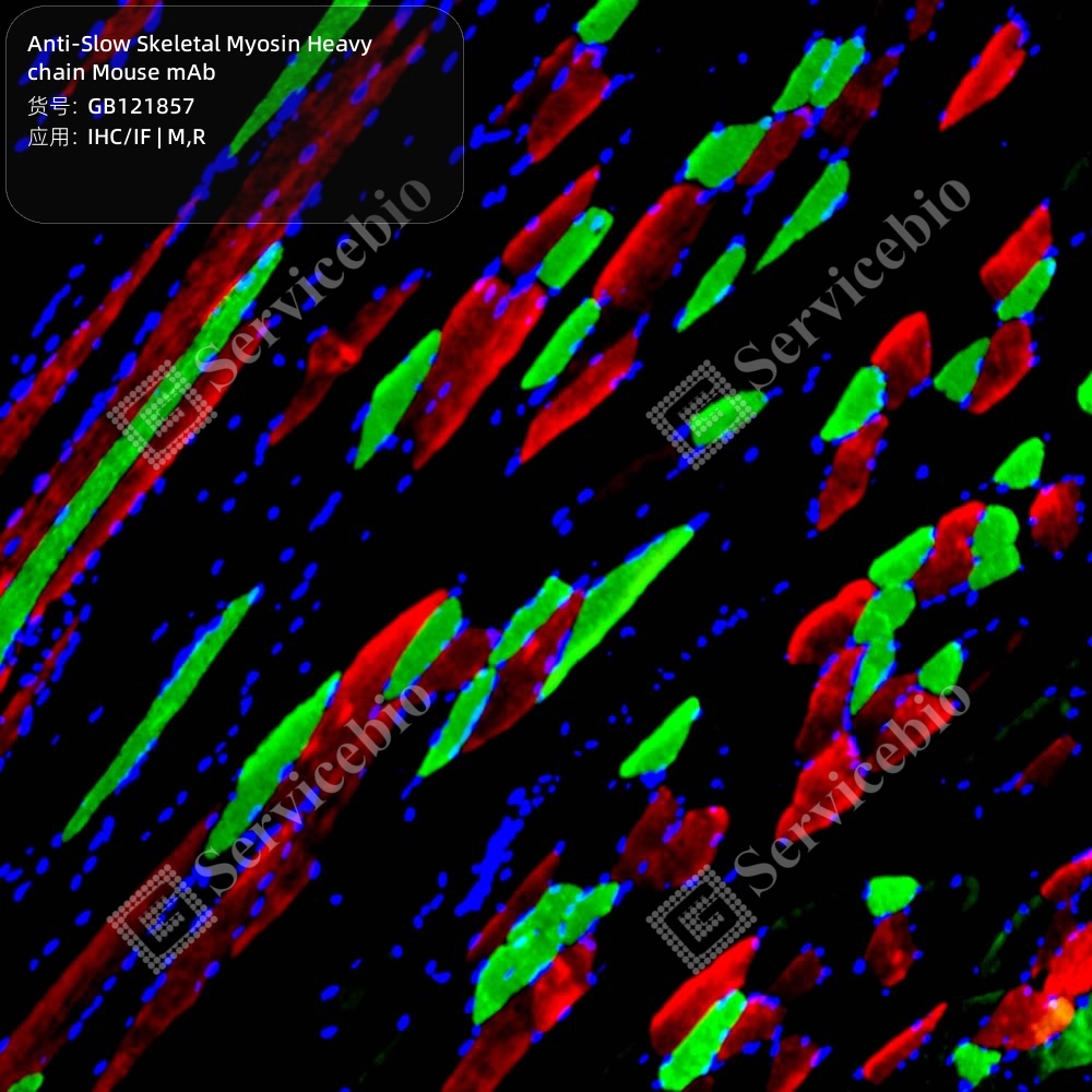赛维尔生物服务|产品_Servicebio_武汉赛维尔生物科技有限公司