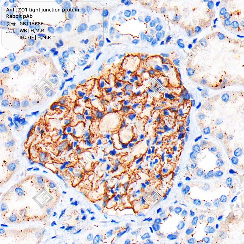 赛维尔生物服务|产品_Servicebio_武汉赛维尔生物科技有限公司