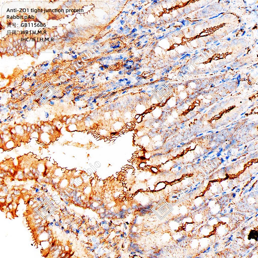赛维尔生物服务|产品_Servicebio_武汉赛维尔生物科技有限公司