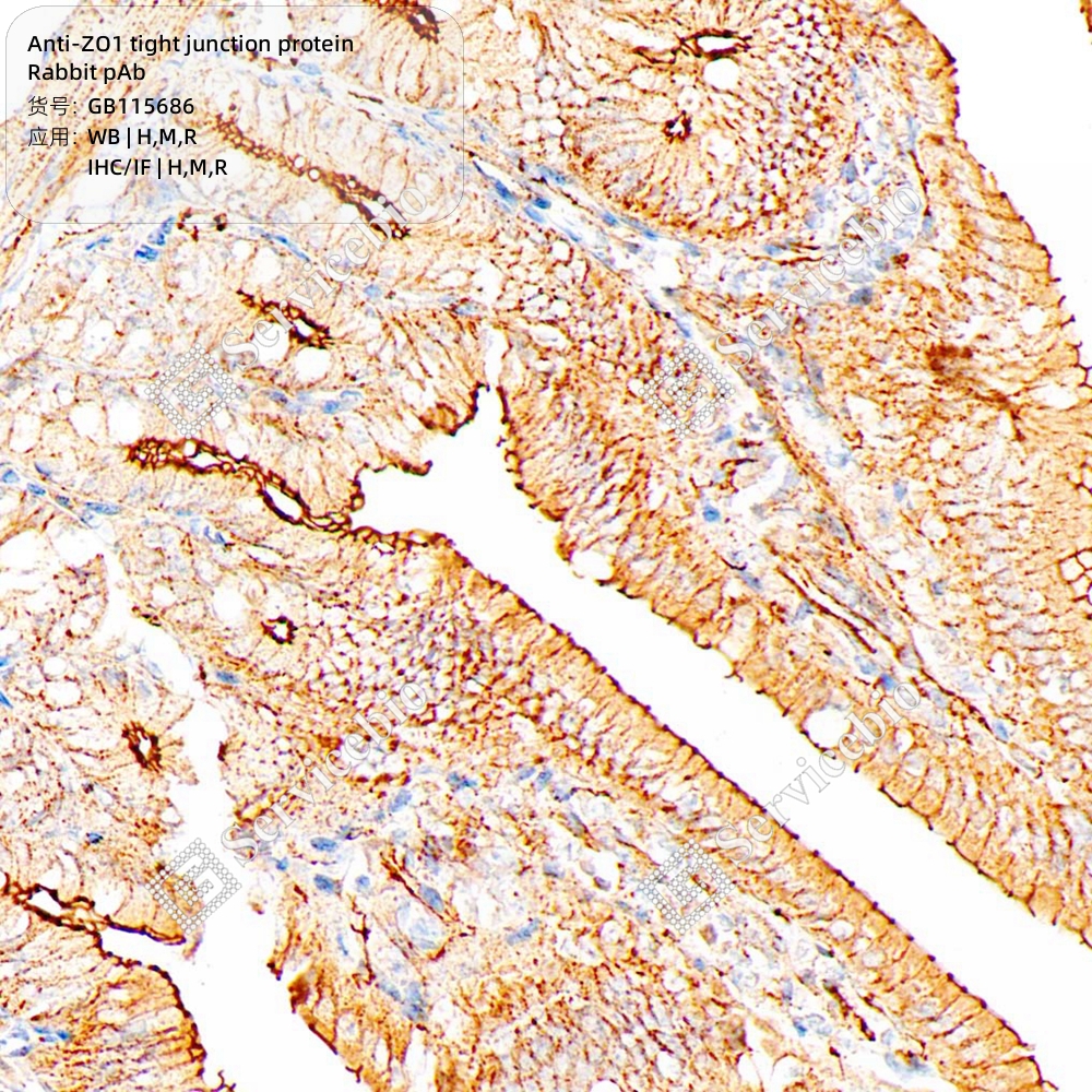 赛维尔生物服务|产品_Servicebio_武汉赛维尔生物科技有限公司