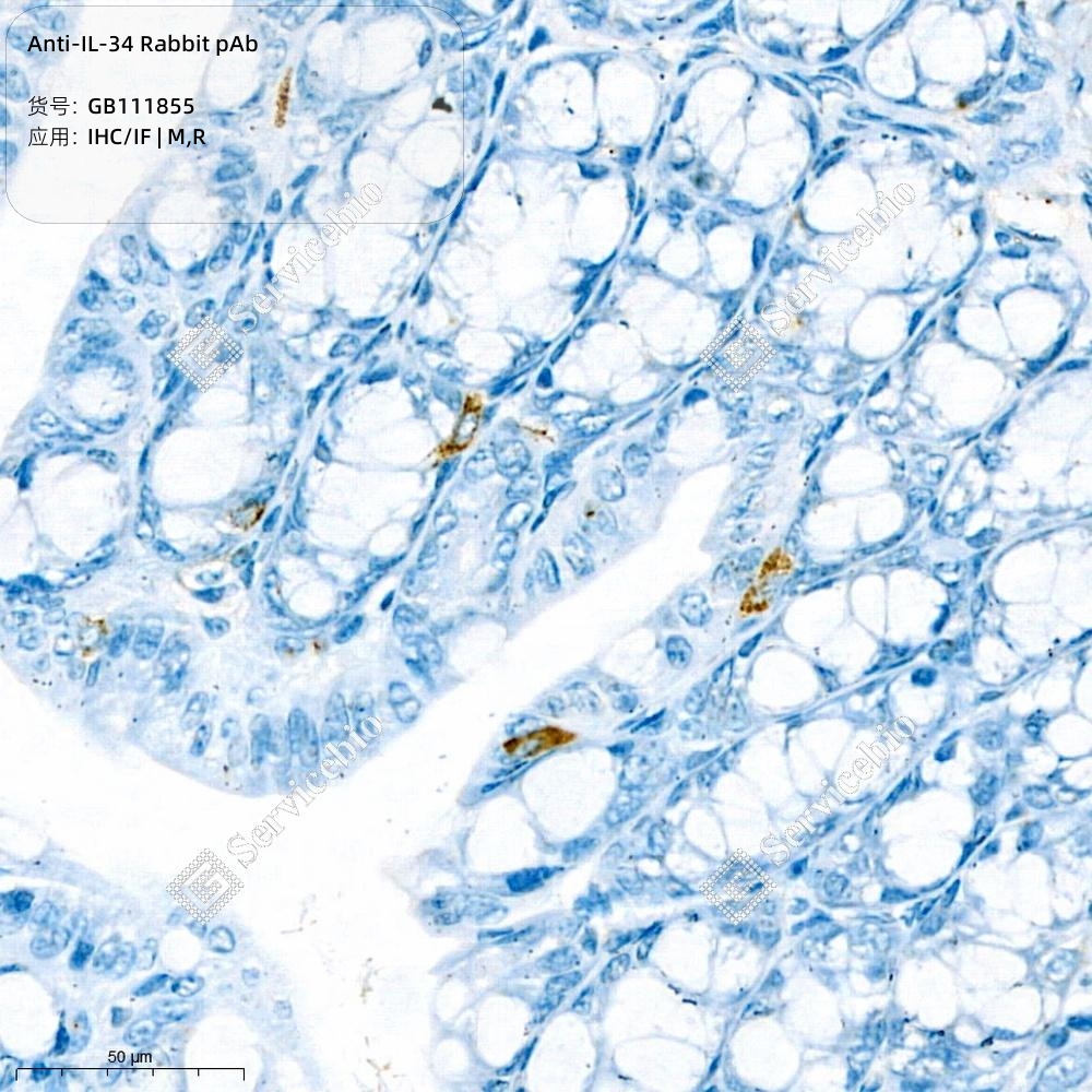 赛维尔生物服务|产品_Servicebio_武汉赛维尔生物科技有限公司