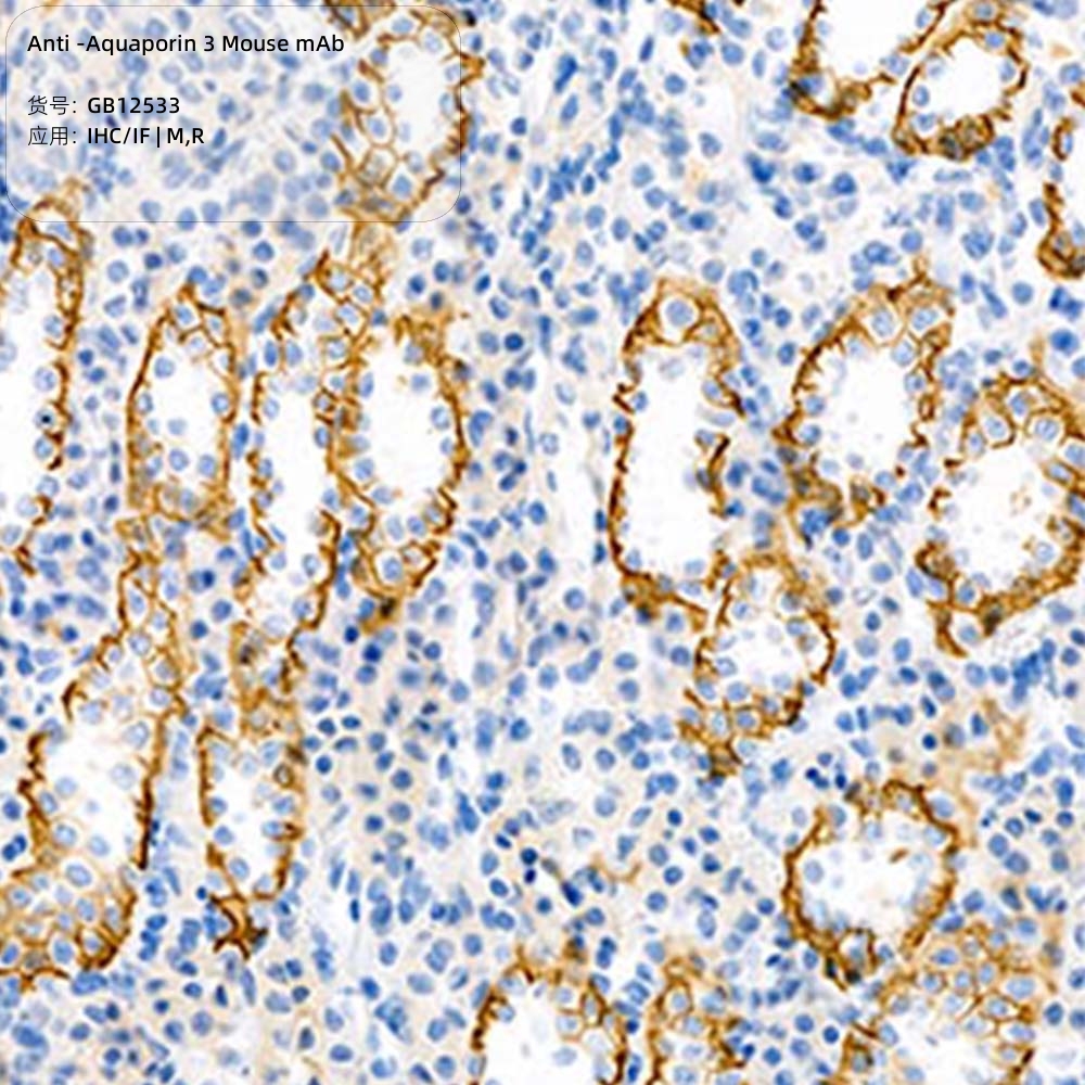 赛维尔生物服务|产品_Servicebio_武汉赛维尔生物科技有限公司